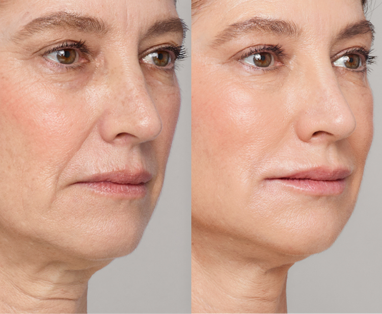 Facial Treatments & Advanced Aesthetics Services Brentwood CA ...